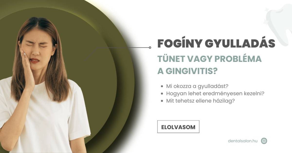 Minden, amit tudnod érdemes a fogínygyulladásról - Dental Salon